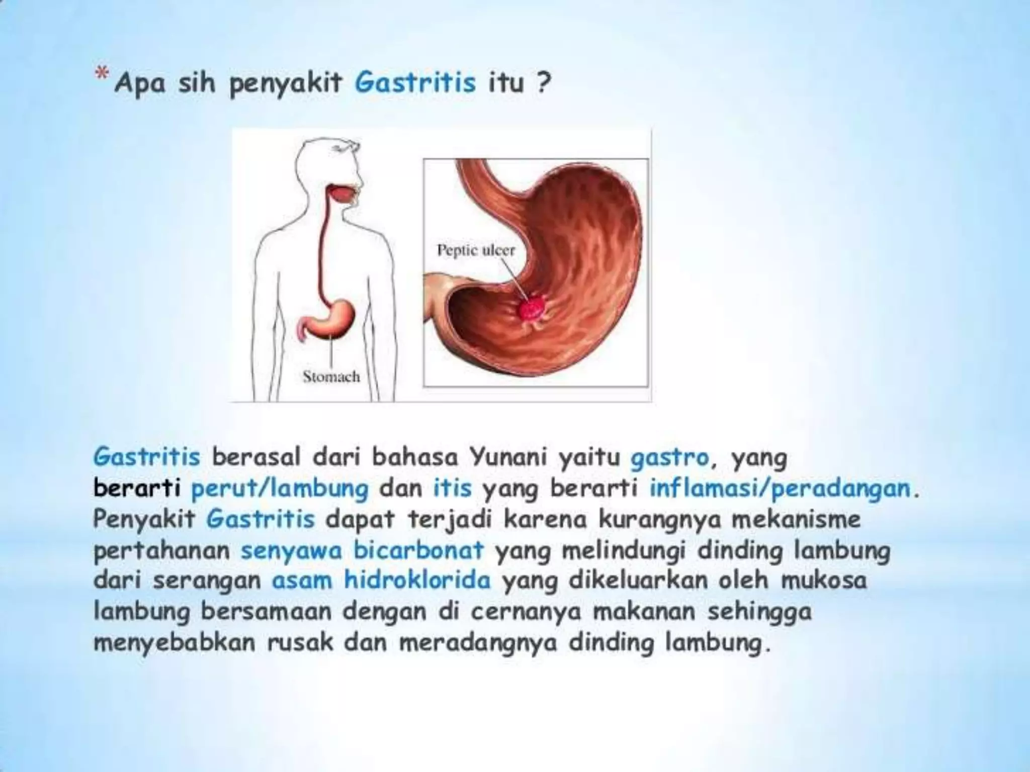 PEPTIC ULCER TUKAK LAMBUNG Patofisiologi peptic ulcer | PPTX