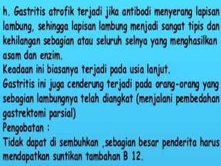 PEPTIC ULCER TUKAK LAMBUNG Patofisiologi peptic ulcer | PPTX