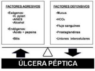 PEPTIC ULCER TUKAK LAMBUNG Patofisiologi peptic ulcer | PPTX