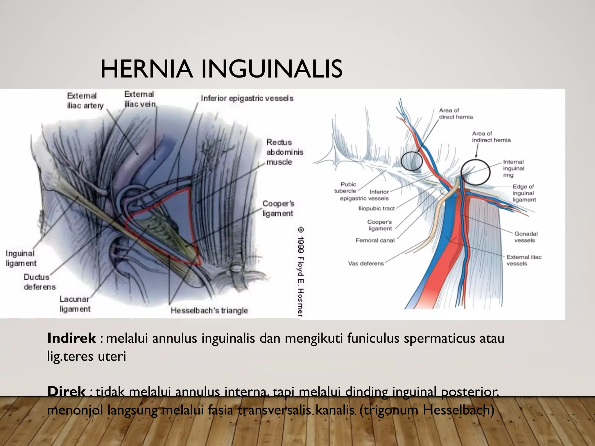 Patofisiologi Penyakit Peptic Ulcer.pdf