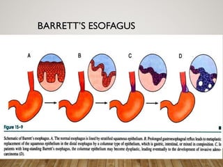 Patofisiologi Penyakit Peptic Ulcer.pdf