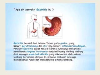 Patofisiologi Tukak Peptik terima kasih.pptx