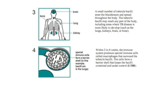 Patogenesis TB paru.pptx