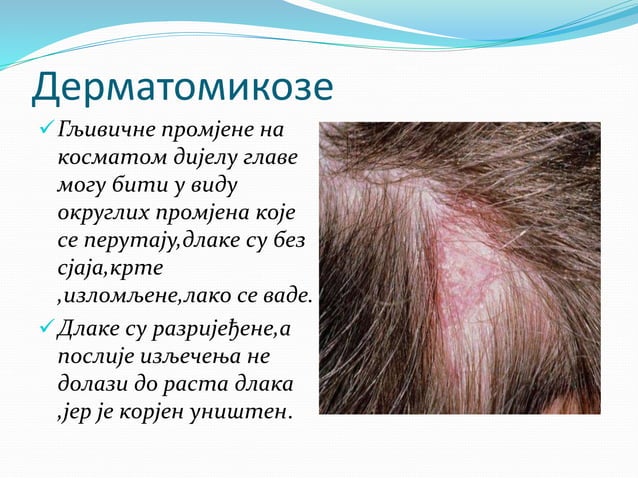 Patogenost gljiva i gljivicna oboljenja iv7 | PPT