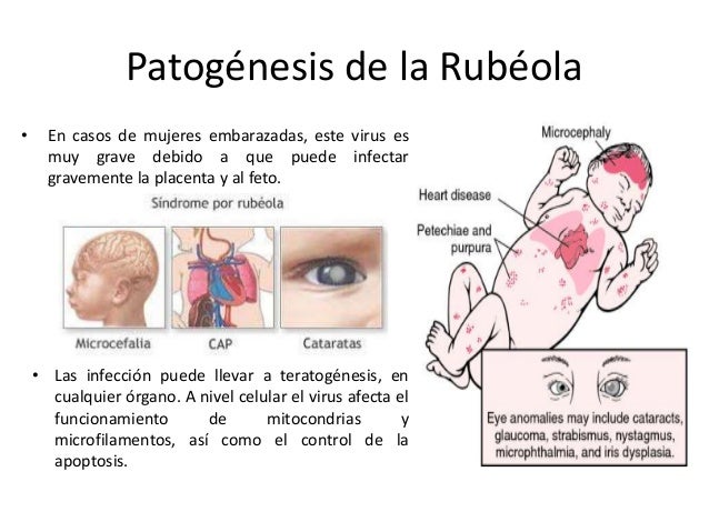 El virus de la rubeola