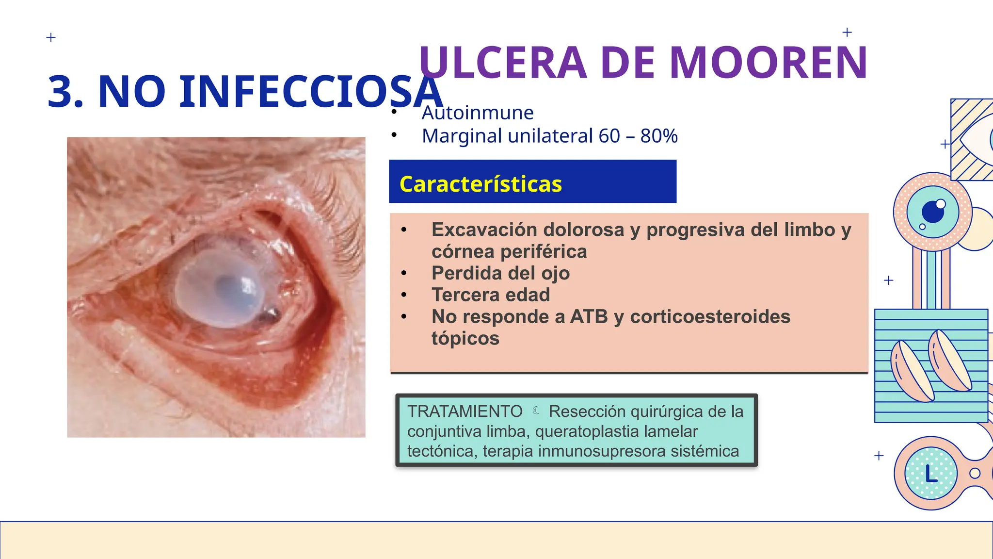 PATOLGÍA CORNEAL sobre escleritis y epiescleritis | PPTX