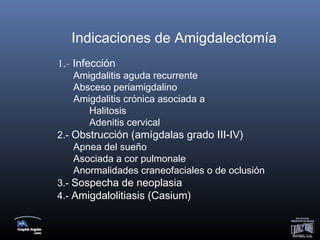Patología amigdalina y amigdalectomía | PPT