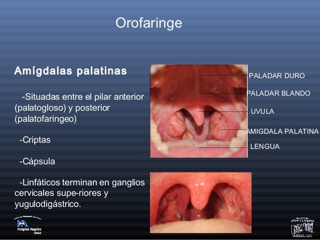 Patología amigdalina y amigdalectomía