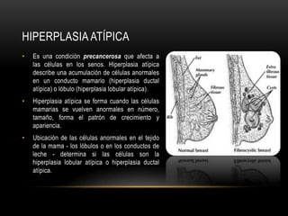 Patología benigna de mama | PPTX