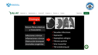 Patología Broncopulmonar ramificaciones.pptx