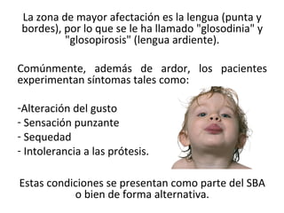 Sindrome de la Boca Ardiente | PPT