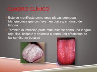 Patología de boca y glándulas salivales Mayra Quiroz Florián | PPTX