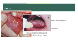 Patología de lengua y mucosa oral | PPTX