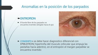 Patología de los parpados | PPTX