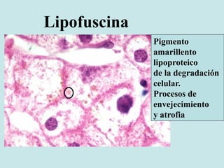 Patología de los pigmentos y minerales | PDF