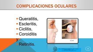 Patología de los senos paranasales cuarta clase | PPTX