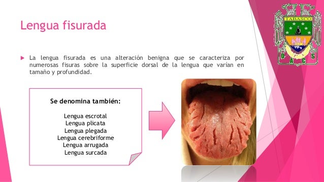 Patología del sistema estomatognático