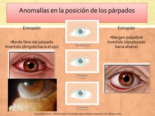 Patología de párpado | PPTX