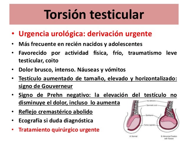 Patología escrotal aguda
