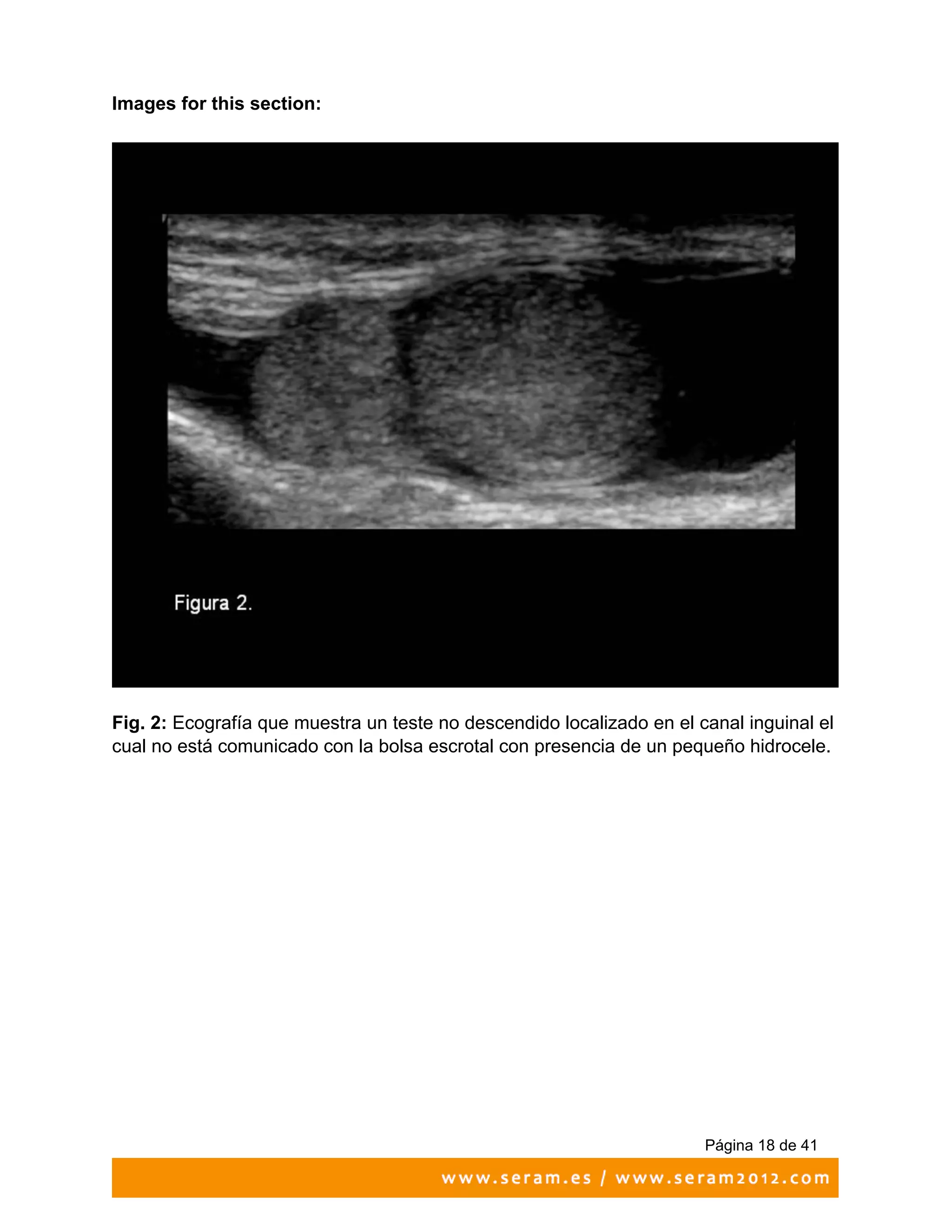 Patología escrotal pediátrica más frecuente seram2012 s-0655 | PDF