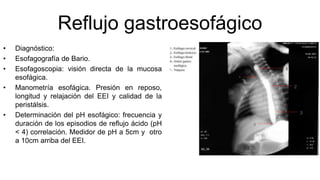 Patología esofágica y hernia diafragmática | PPTX