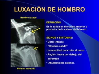 Patología Hombro | PPT