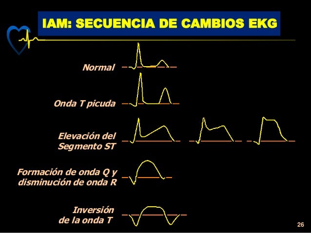 Patología isquemica e iam