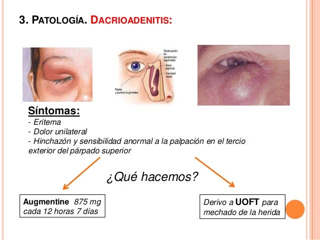 Patología oftalmológica frecuente y recurrente