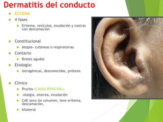 Patología OIDO EXTERNO.pptx
