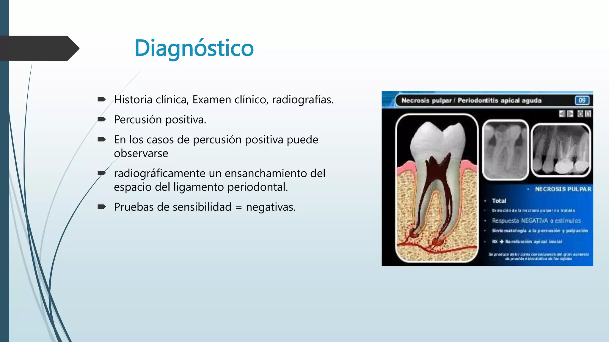 Patología pulpar y periapical 1.pptx
