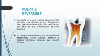 Patología pulpar y periapical 1.pptx