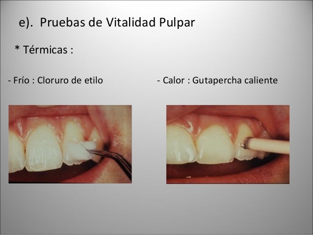 Patología pulpar y periapical 2