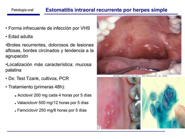 Patologías de la cavidad oral.pptx