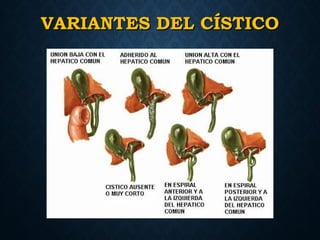 Variaciones De La Arteria Cística
