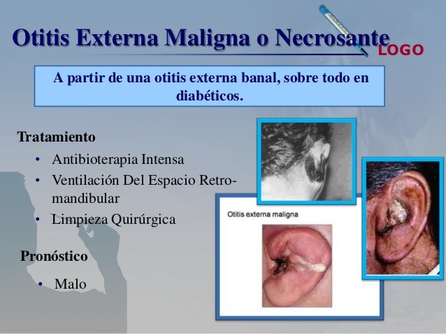 Patologías del conducto auditivo externo