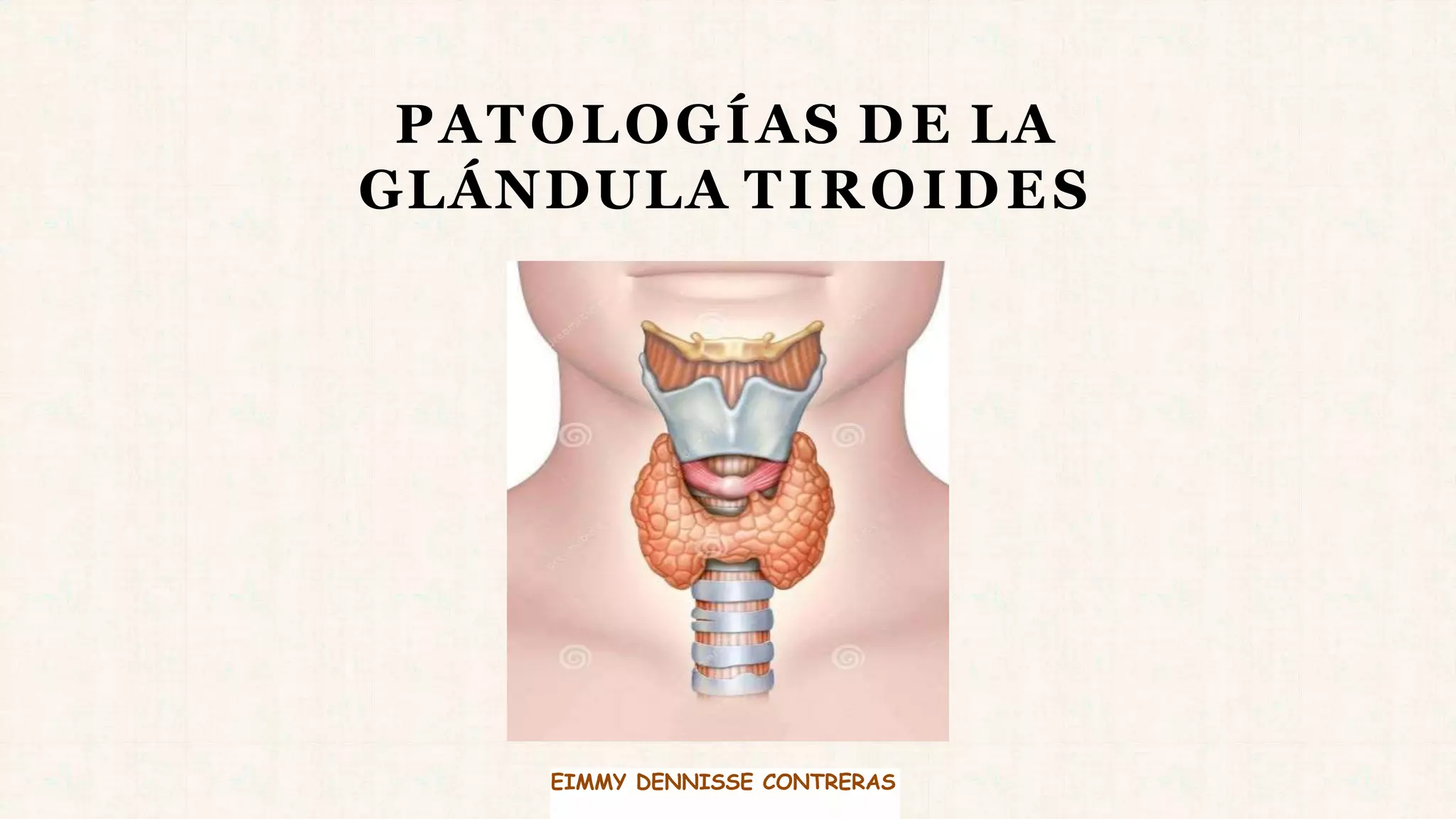 patologías de tiroides eimmyyyyy.pptx
