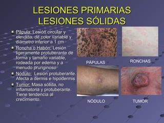 Patologías frecuentes de la piel | PPT