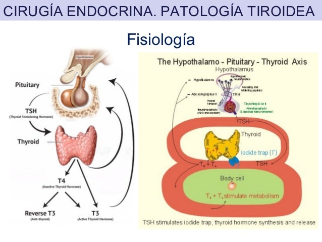 Patología tiroidea