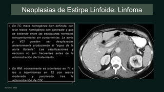 Patología Tumoral Retroperitoneal Primaria.pptx