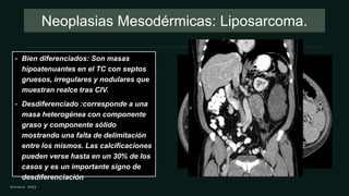 Patología Tumoral Retroperitoneal Primaria.pptx