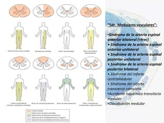 Patología vascular medular. | PPTX