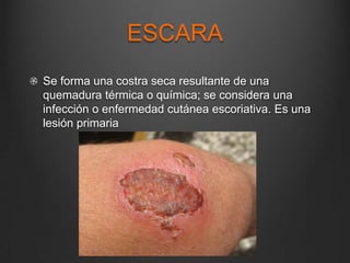 Patologia- Lesiones de la piel frecuentes | PPT