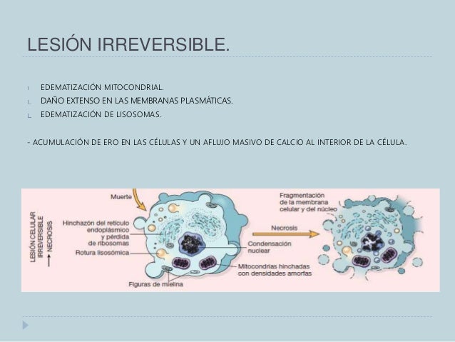 - CORRELACIONES CLÍNICO-PATOLÓGICAS: EJEMPLOS DE LESIÓN CELULAR Y DE…