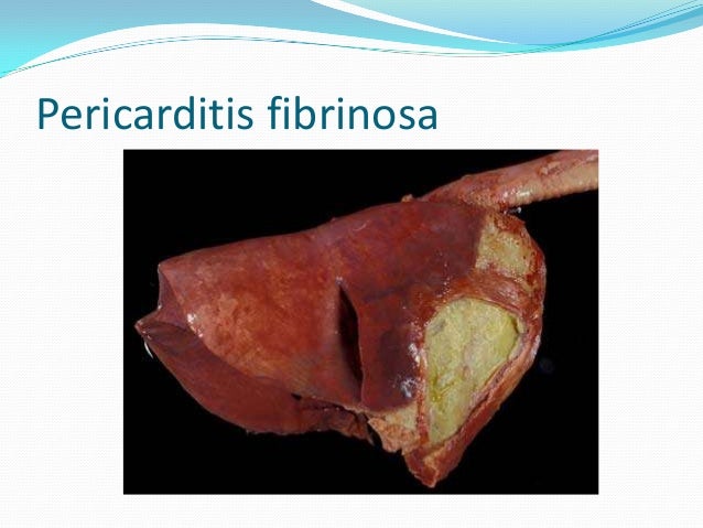 Patologia cardiaca