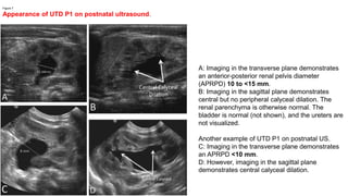 Patologia anomalia renal congenita rx us tc | PDF