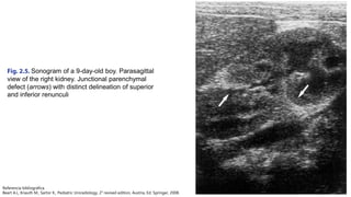 Patologia anomalia renal congenita rx us tc | PDF