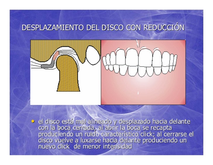 Patologia De Atm