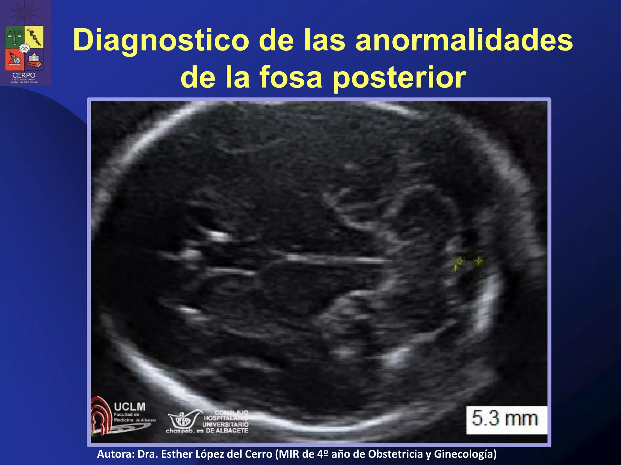 patologia-fosa-posterior;-dra-ana-jara-zegarra_archivo.pdf