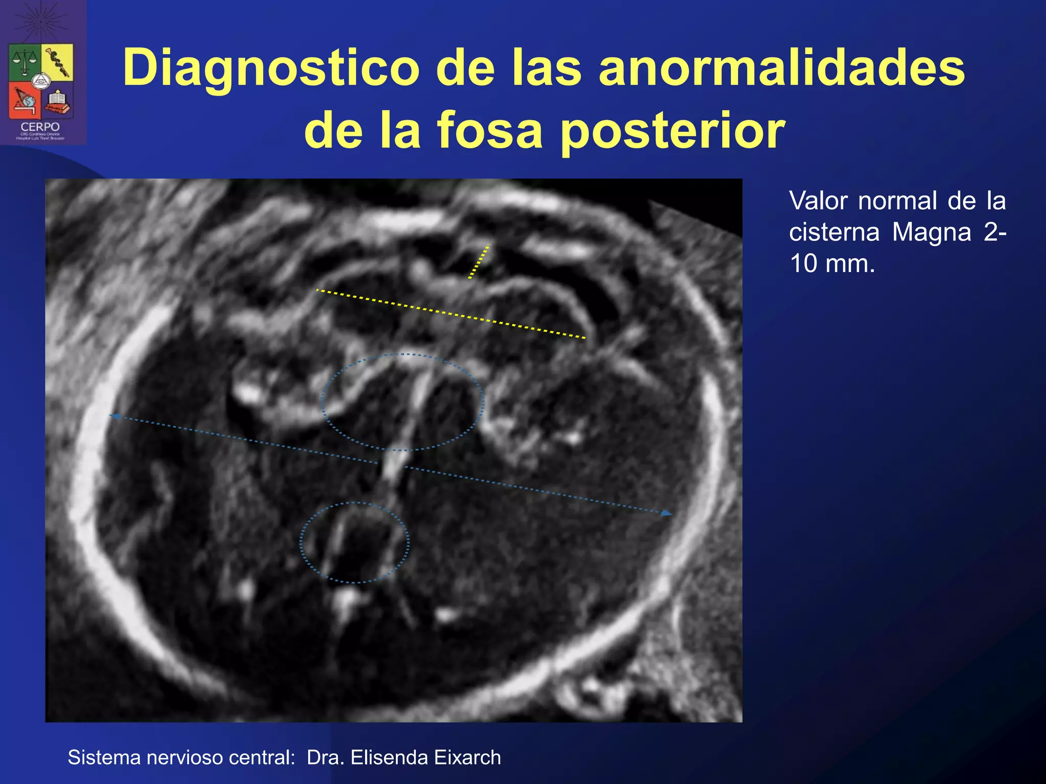 patologia-fosa-posterior;-dra-ana-jara-zegarra_archivo.pdf