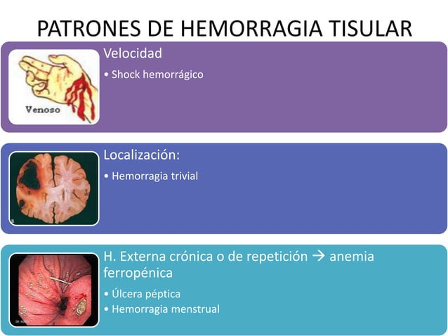 Patologia 5 a hiperemia y congestión | PPT